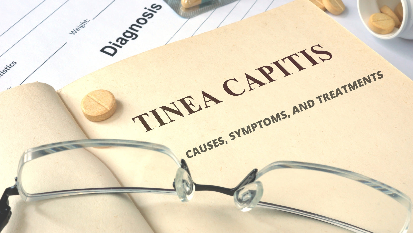 Understanding Tinea Capitis – Lengths By Rihzé Qiré